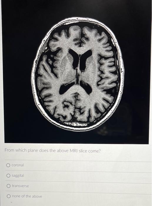 Solved From which plane does the above MRI slice come? | Chegg.com