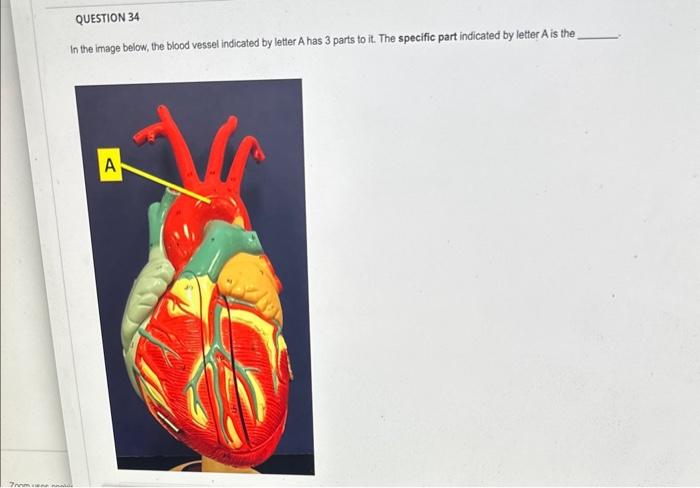 Solved In the image below, the blood vessel indicated by | Chegg.com