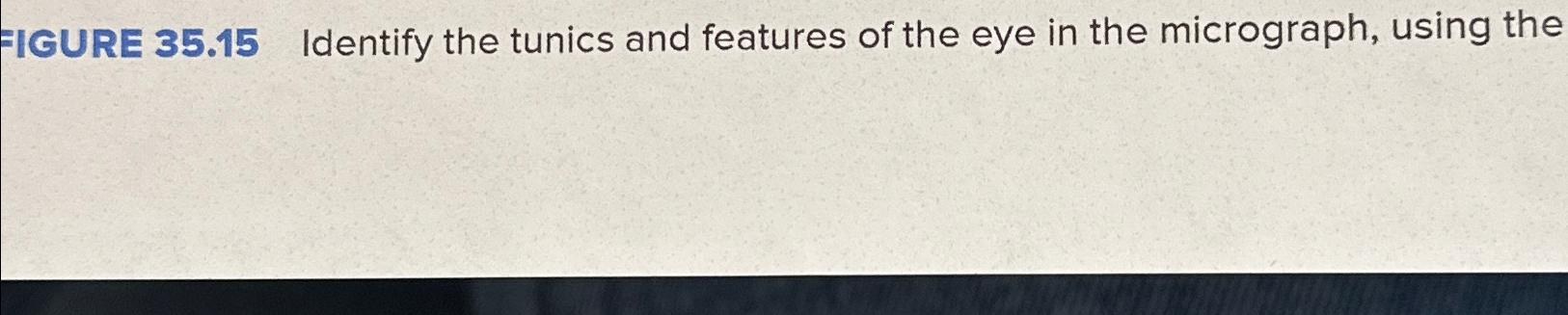 Solved FIGURE 35.15 ﻿Identify the tunics and features of the | Chegg.com