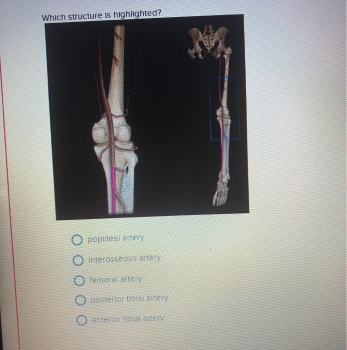 Solved Which structure is highlighted? popliteal artery O | Chegg.com