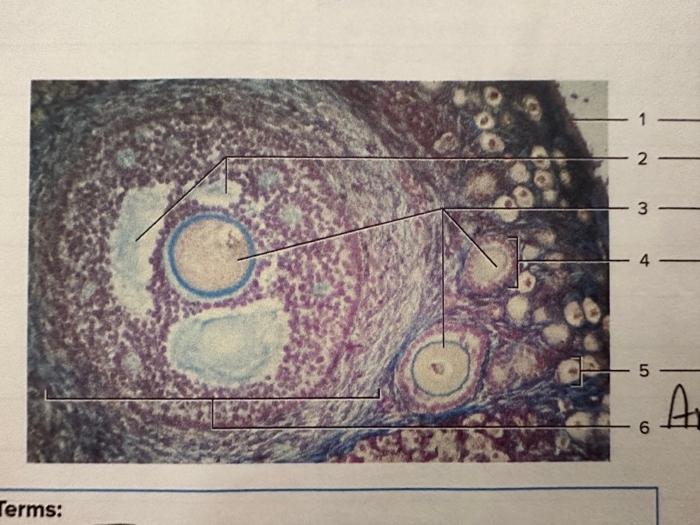 Solved label the micrograph of a section of an ovary using | Chegg.com Solved label the micrograph of a section of an ovary using | Chegg.com