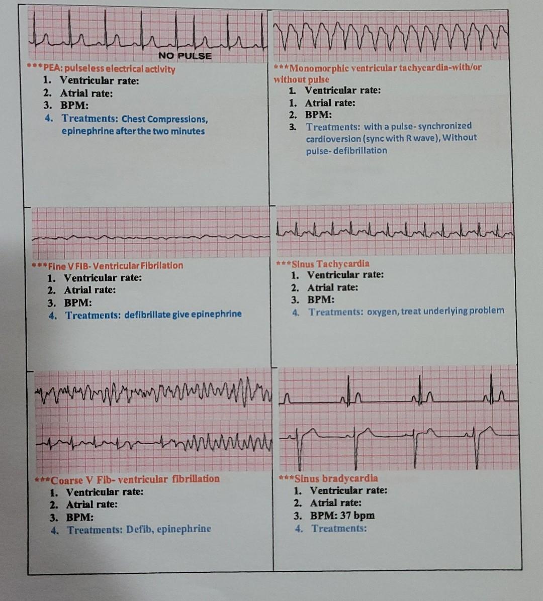 Pulseless Electrical Activity Vs Ventricular Fibrillation