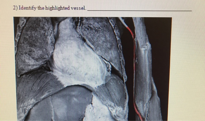 Solved 1) Identify the highlighted vessels. 2) Identify | Chegg.com