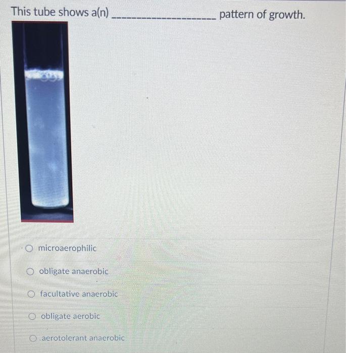Solved This tube shows a(n) pattern of growth. areotolerant | Chegg.com