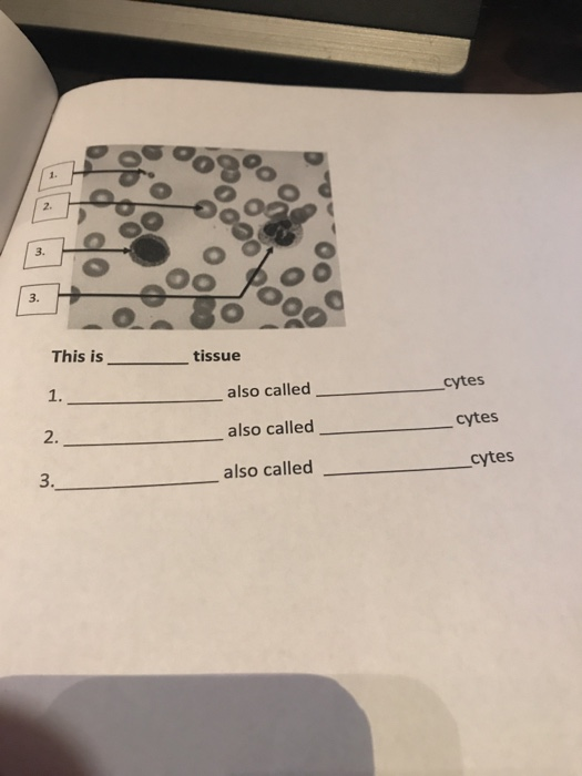 Solved This is tissue also called _cytes cytes also called | Chegg.com