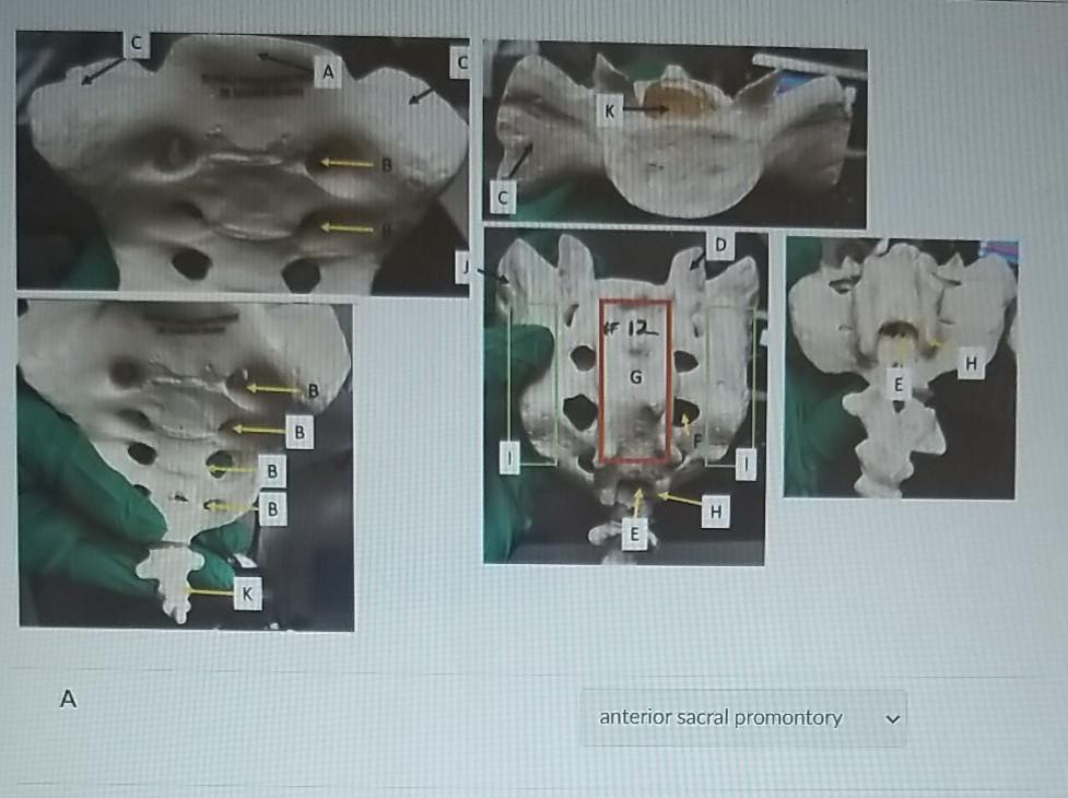 Solved A к с D н B В В н K A anterior sacral promontory у | Chegg.com