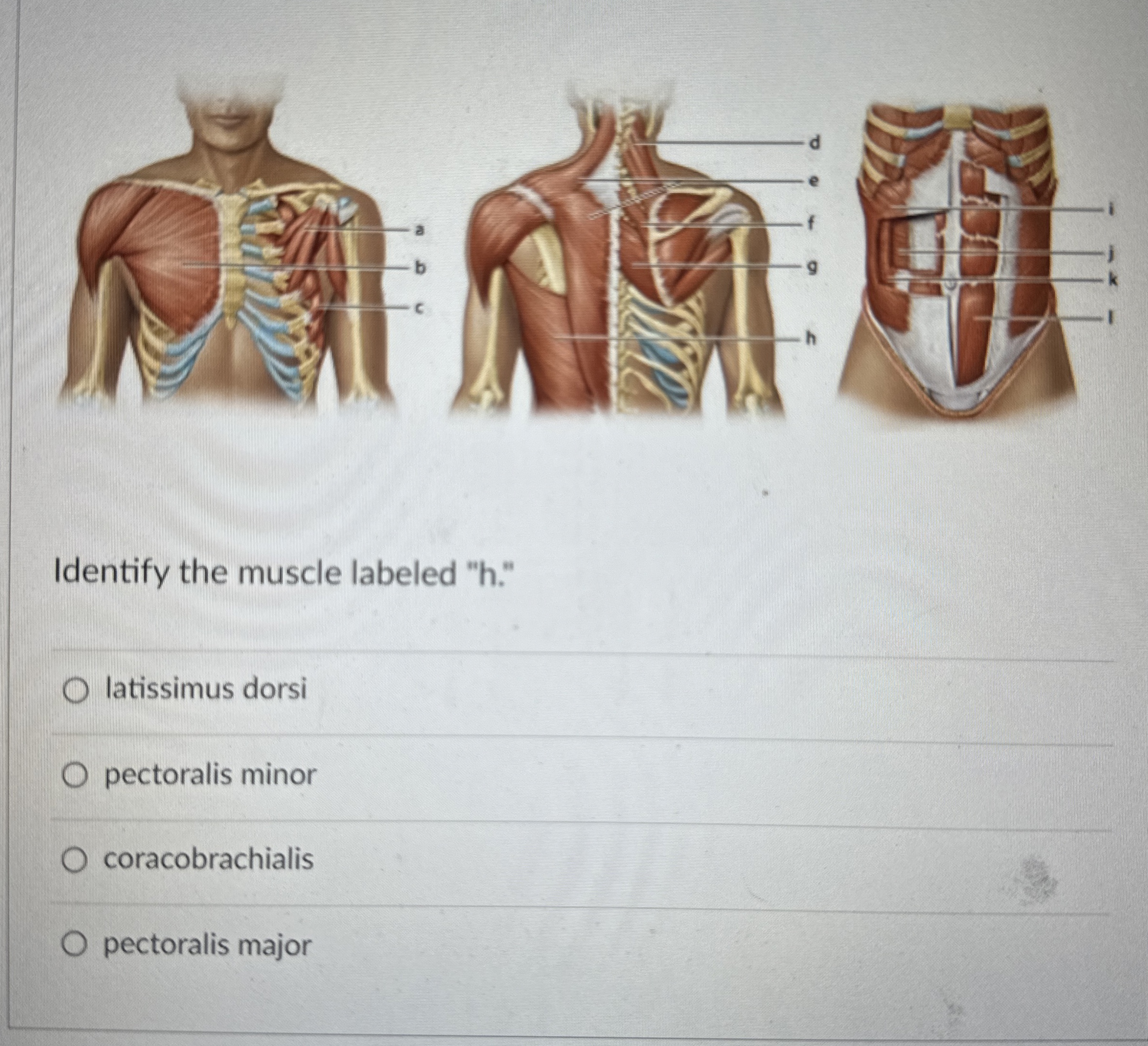 Solved Identify the muscle labeled "h."latissimus | Chegg.com
