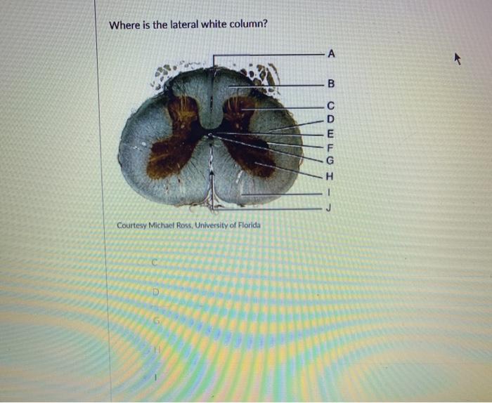 Solved Where is the lateral white column? A B с D E F G H | Chegg.com