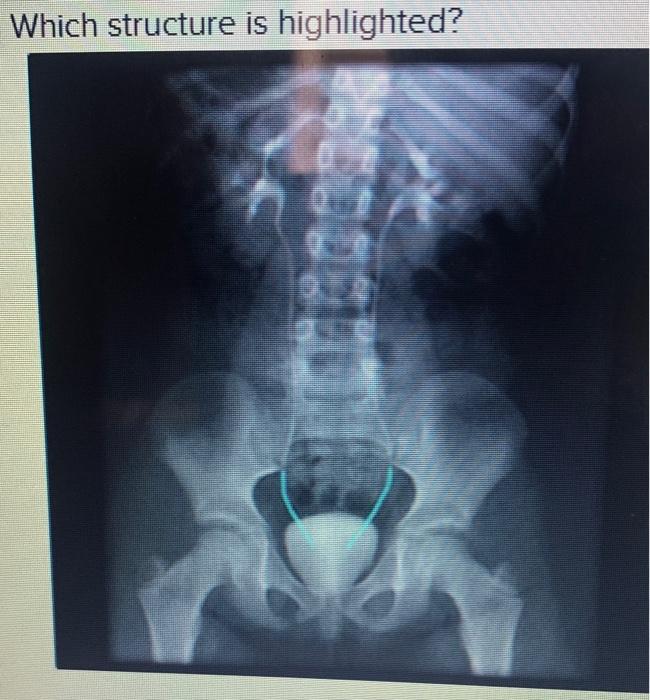 Solved Which structure is highlighted? SEGOBEE O cortex | Chegg.com