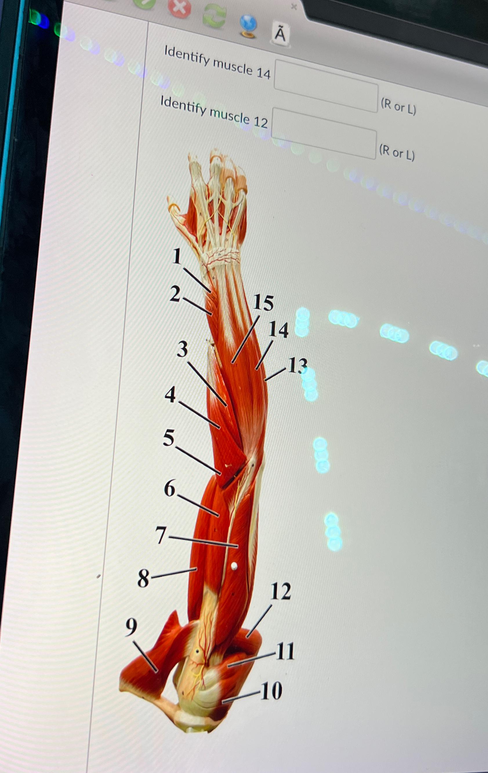 Solved Identify muscle 14tilde(A)D ( R ﻿or L)Identify muscle | Chegg.com