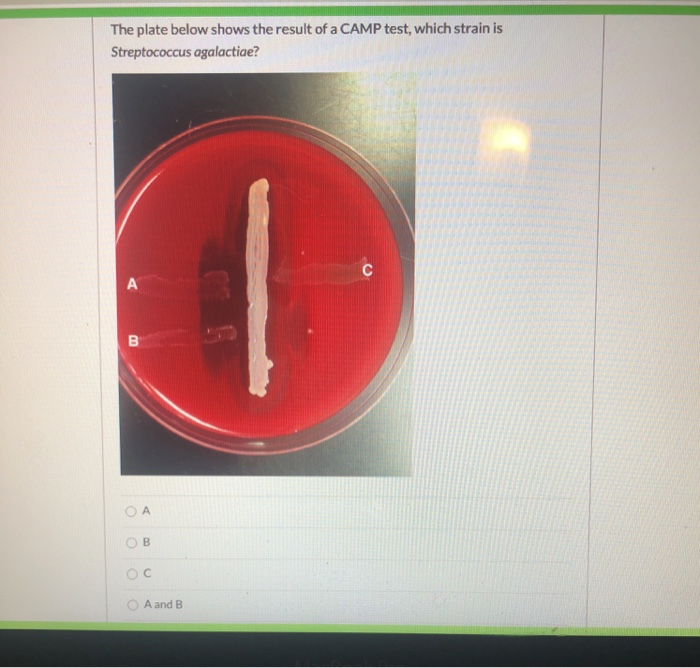 Solved The plate below shows the result of a CAMP test, | Chegg.com