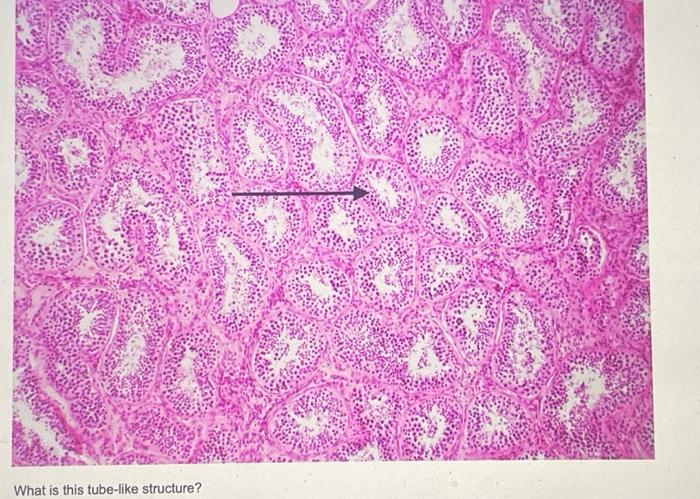 Solved What is tnis tude-llke struciurer | Chegg.com