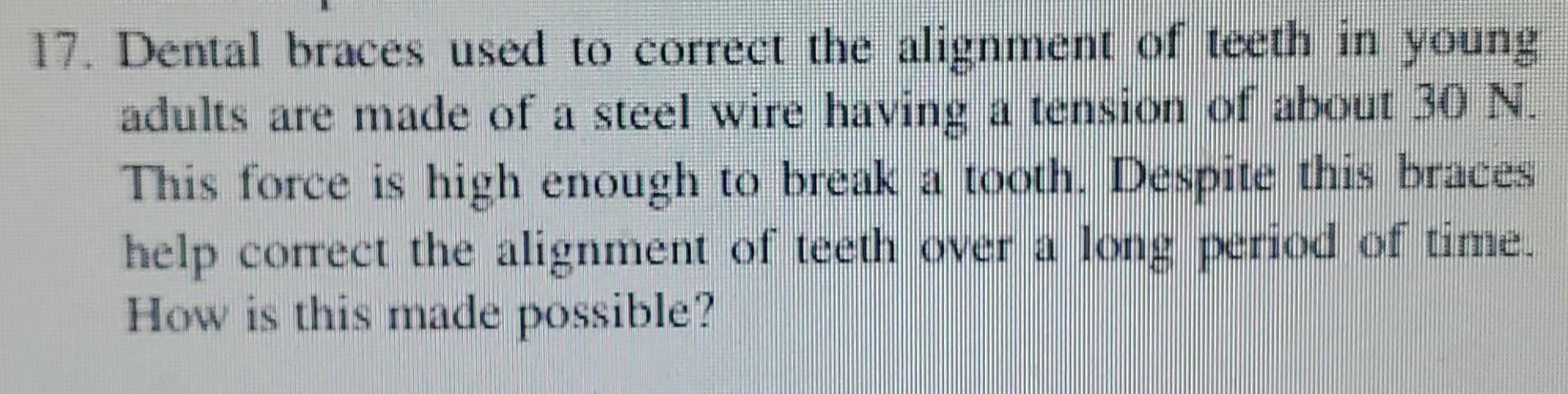 Solved 77. Dental braces used to correct the alignment of | Chegg.com