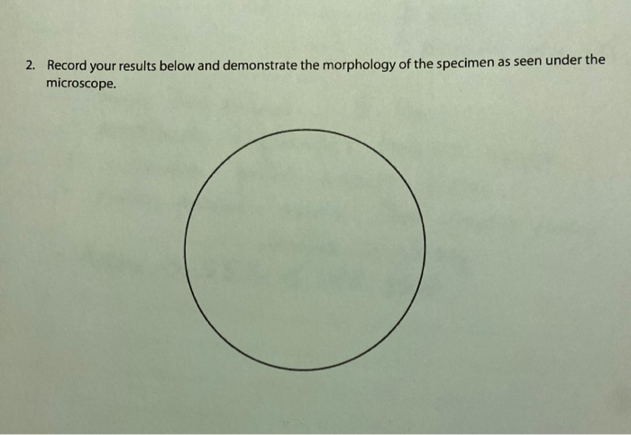 Solved Negative Stain – R. rubrum 9 10 The stain used was | Chegg.com