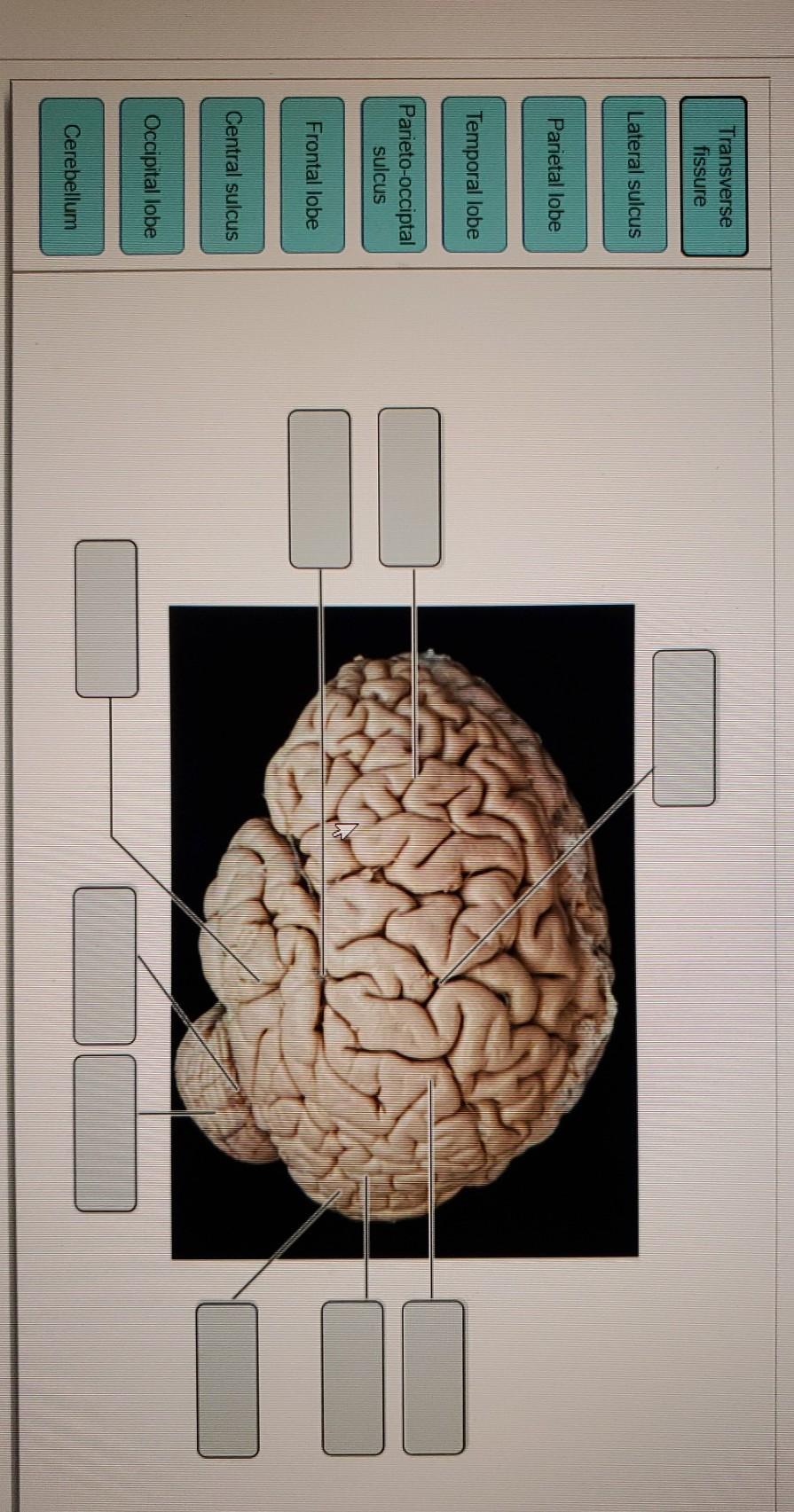Solved Transverse fissure Lateral sulcus Parietal lobe | Chegg.com