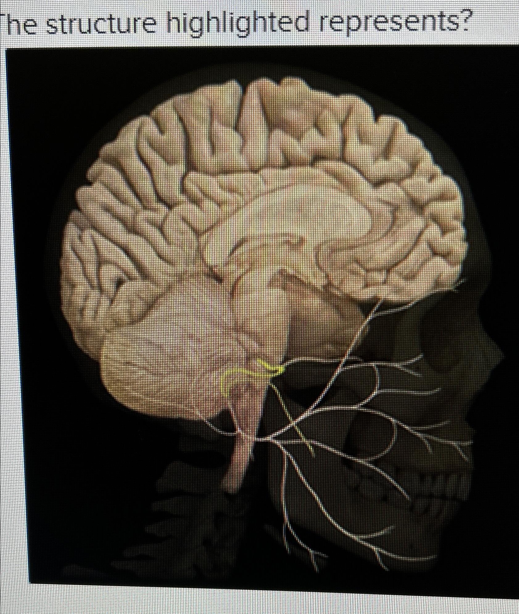 Solved The structure highlighted represents | Chegg.com