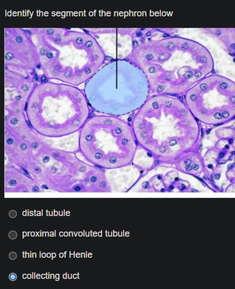 Solved Identify the segment of the nephron belowdistal | Chegg.com