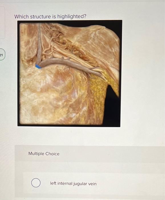 Solved left internal jugular vein, left external jugular | Chegg.com
