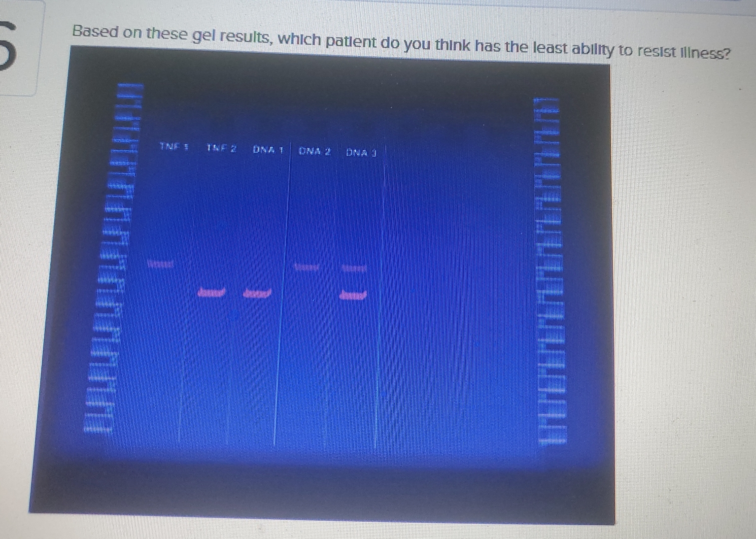 Solved Based on these gel results, which patlent do you | Chegg.com