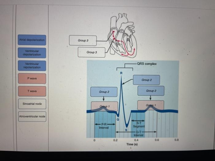 Solved Atrial depolarization Group 3 Ventricular | Chegg.com