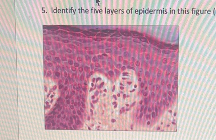 Solved 5. Identify the five layers of epidermis in this | Chegg.com