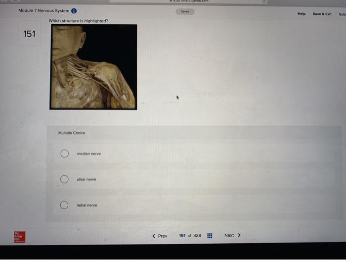 concom Module 7 Nervous System Saved Help Save & Exit | Chegg.com