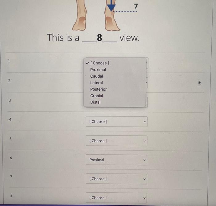 This is a 8 view. | Chegg.com