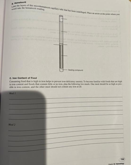 Solved B. Hematocrit Label the layers of this | Chegg.com