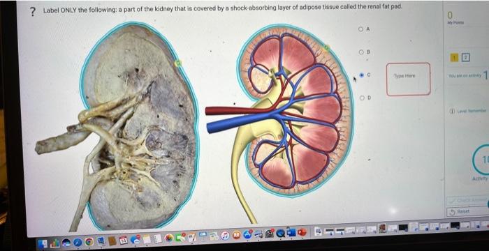 label only the following . a part of the kidney that | Chegg.com
