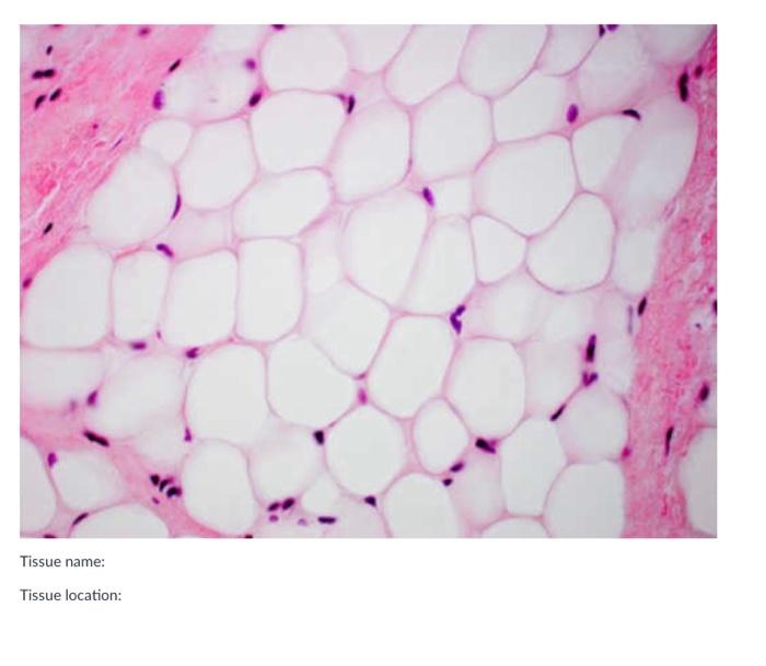 Solved Tissue Name: Tissue Location (only 1): Tissue | Chegg.com