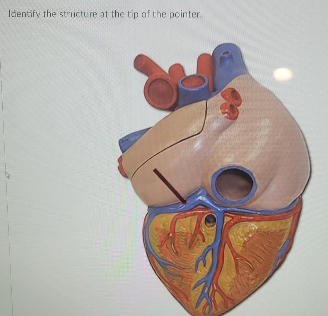 Solved Identify the part of the conducting system at the tip | Chegg.com