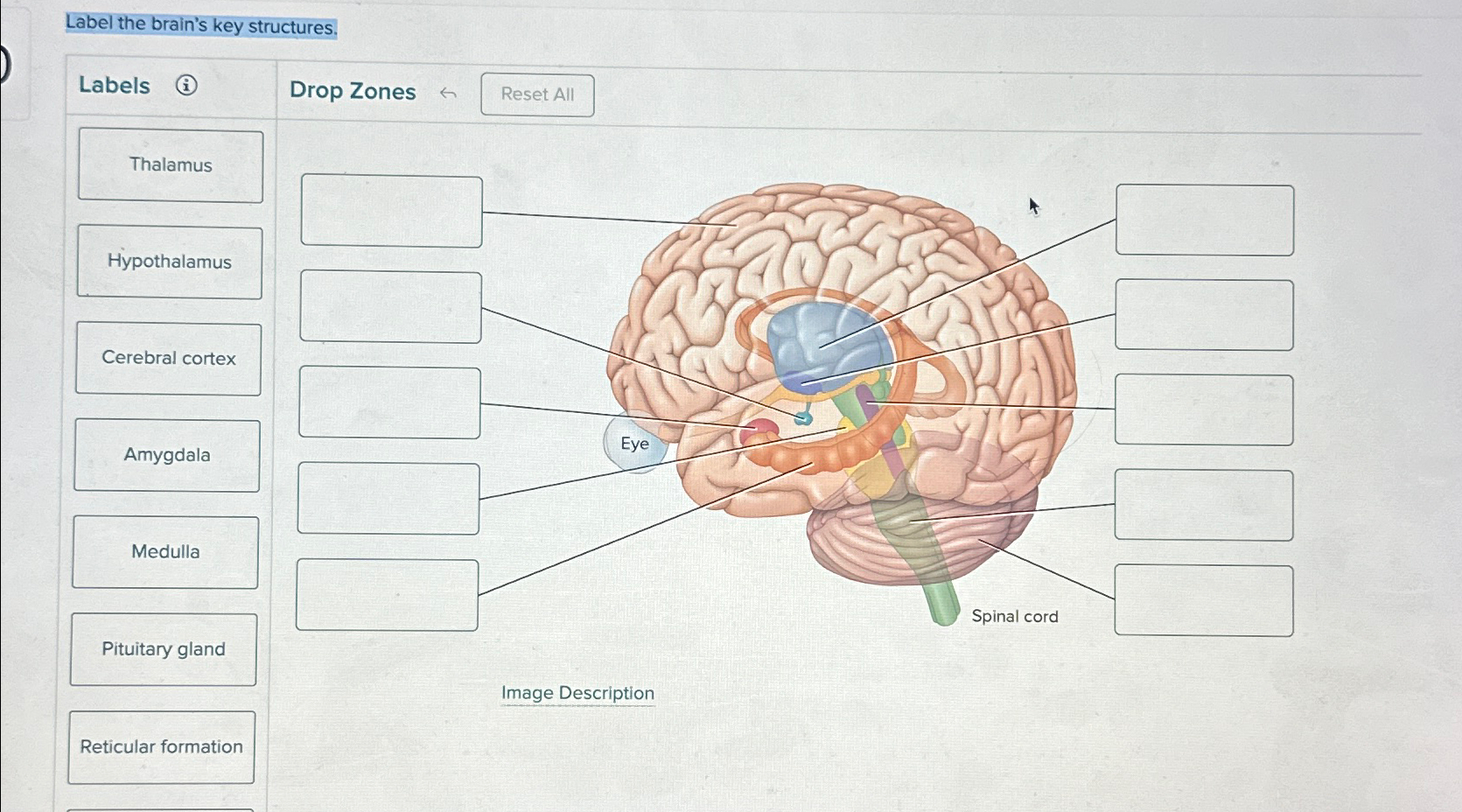 Label the brain's key structures. | Chegg.com