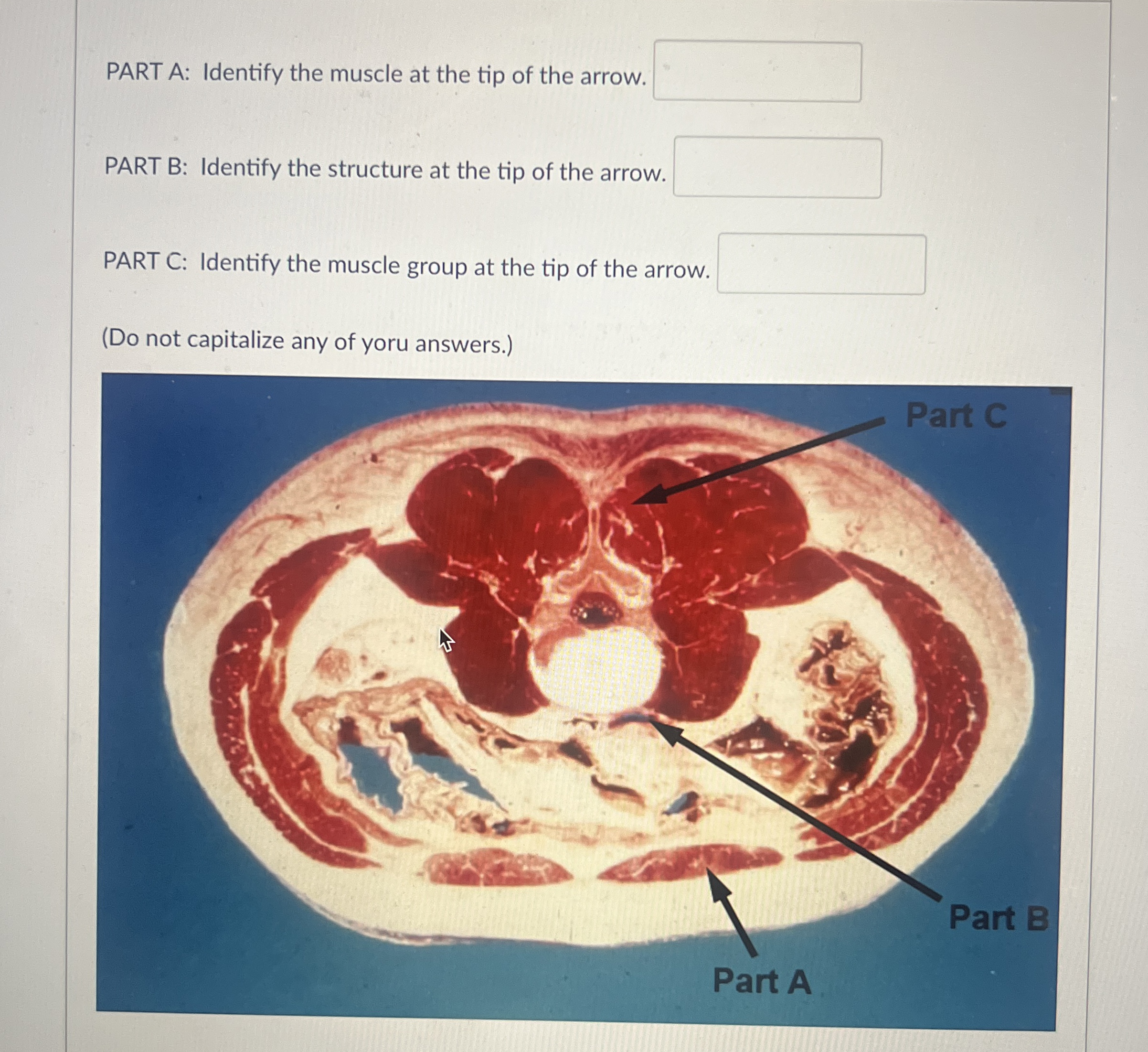 Solved PART A: Identify the muscle at the tip of the | Chegg.com