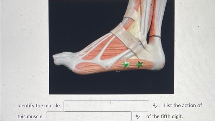 [Solved]: Identify the muscle. this muscle. A List the acti