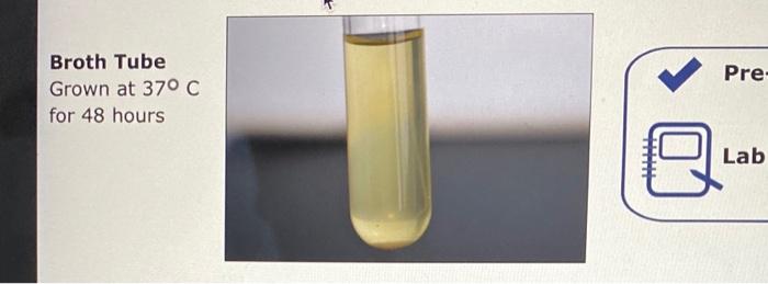 Solved describe the growth as it appears in the broth tube | Chegg.com