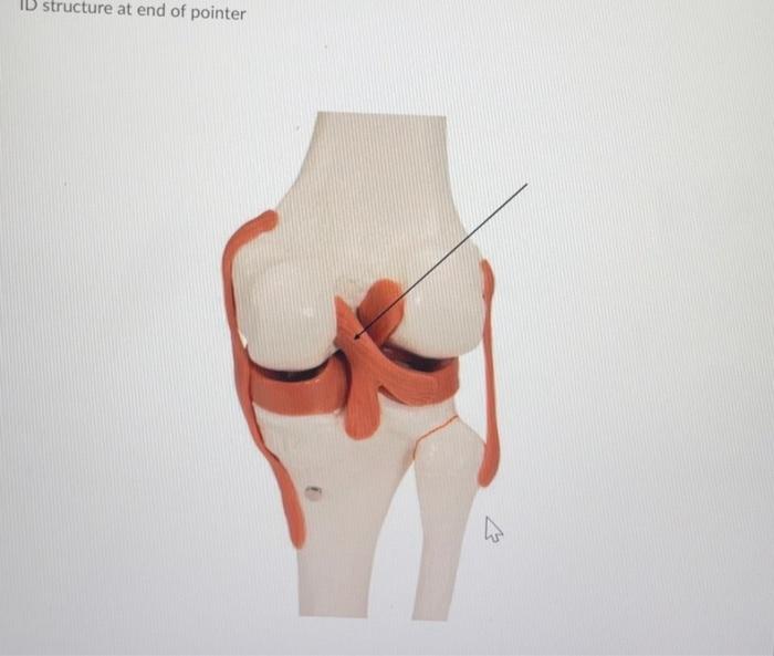 Solved Identify the structure at the tip of the | Chegg.com