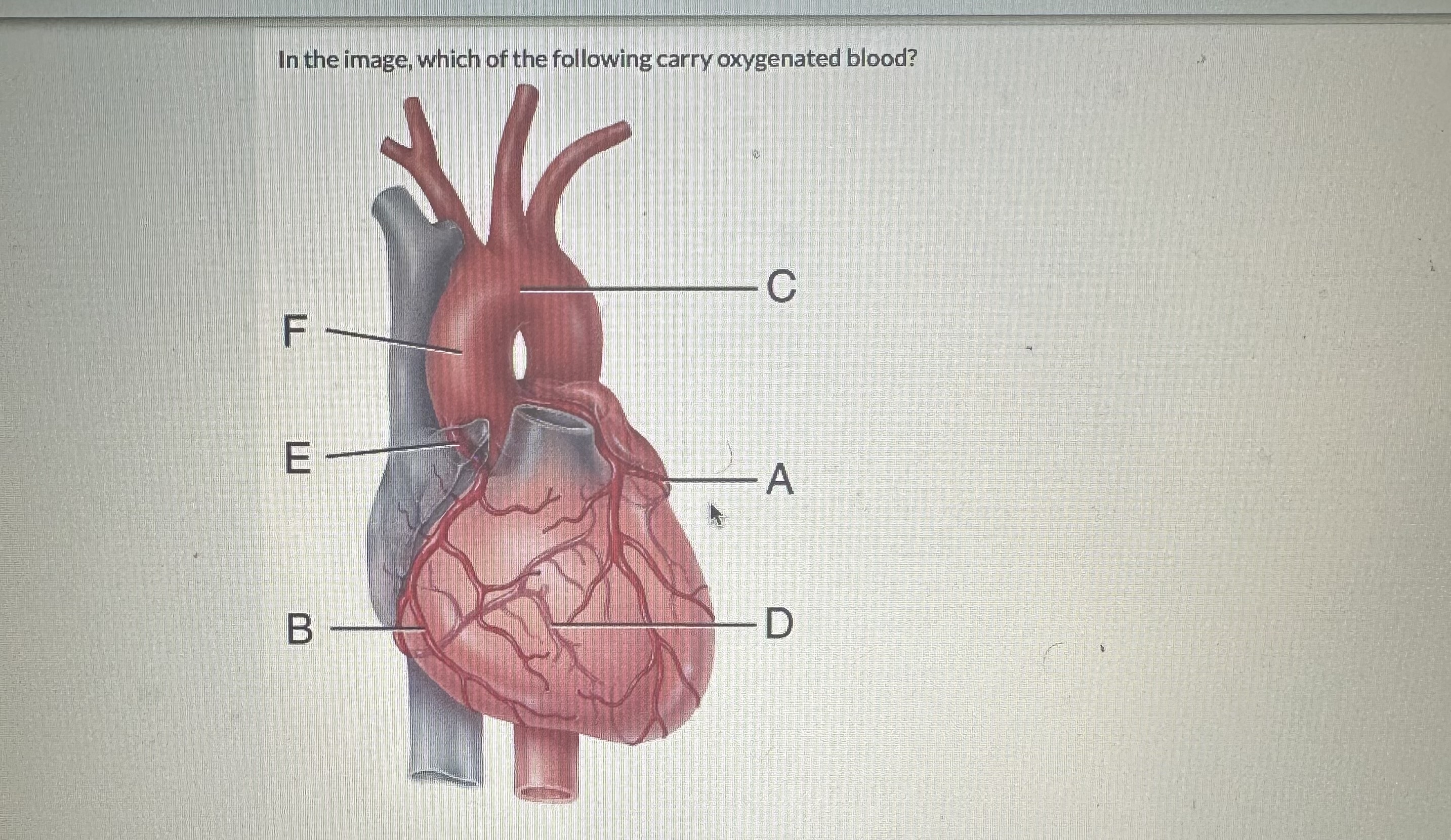 Solved In the image, which of the following carry oxygenated | Chegg.com