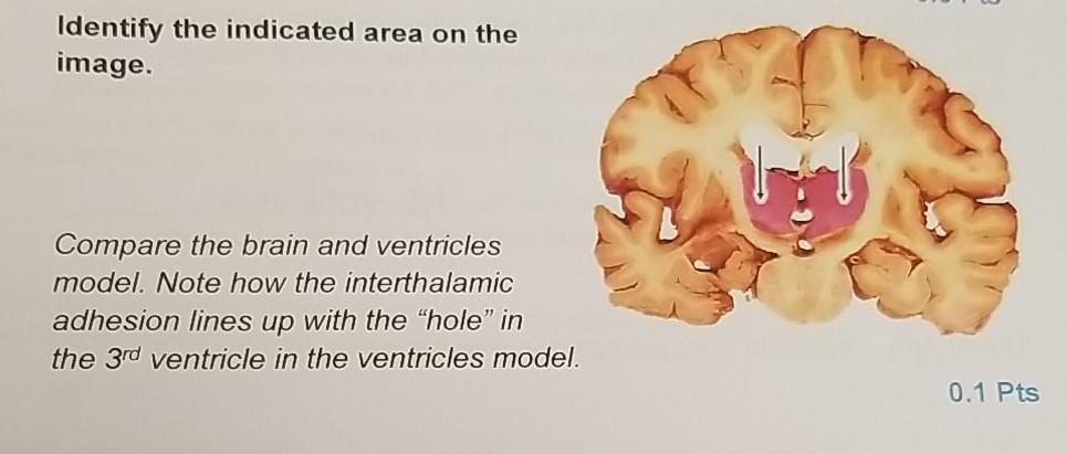 Solved Identify the indicated area on the image. Compare the | Chegg.com