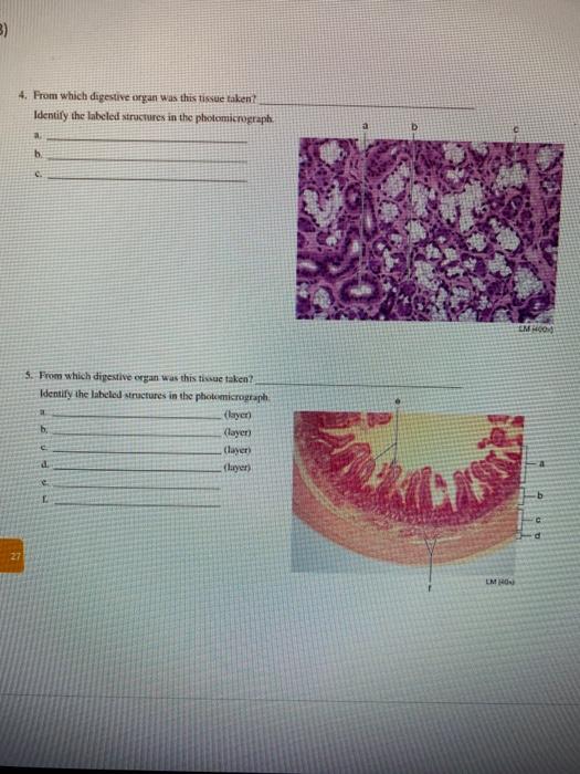 Solved Post Abs Are In Mastering Anatomy And Physiology