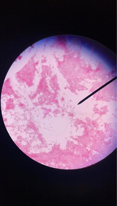 Solved identify the unknown morphology | Chegg.com