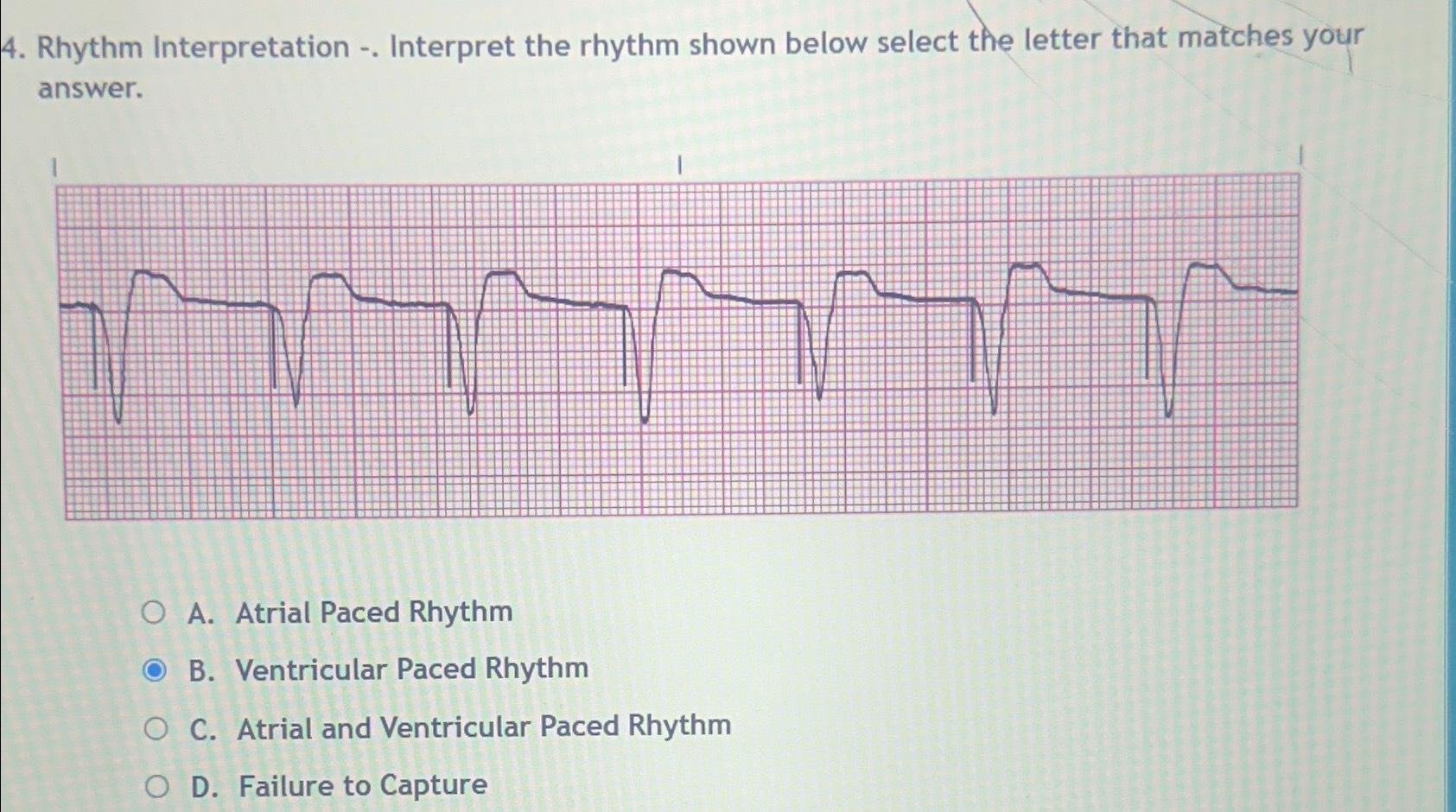 Solved Rhythm Interpretation -. ﻿Interpret the rhythm shown | Chegg.com