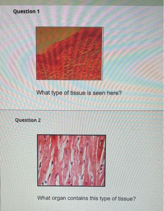 Solved Question 1 What type of tissue is seen here? Question | Chegg.com