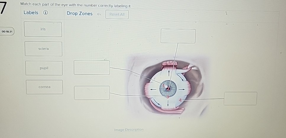 Solved Match each part of the eye with the number correctly | Chegg.com