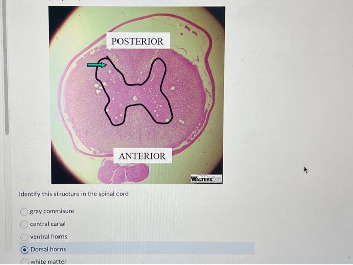 Solved Identify this structure in the spinal cord gray | Chegg.com