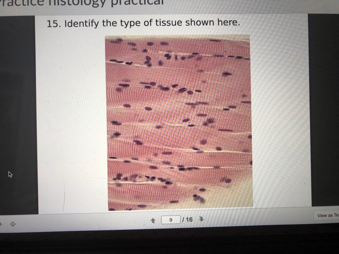 Solved 12. Identify the type of tissue marked by the yellow | Chegg.com