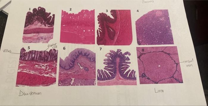 Solved identify and label each histology | Chegg.com Solved identify and label each histology | Chegg.com