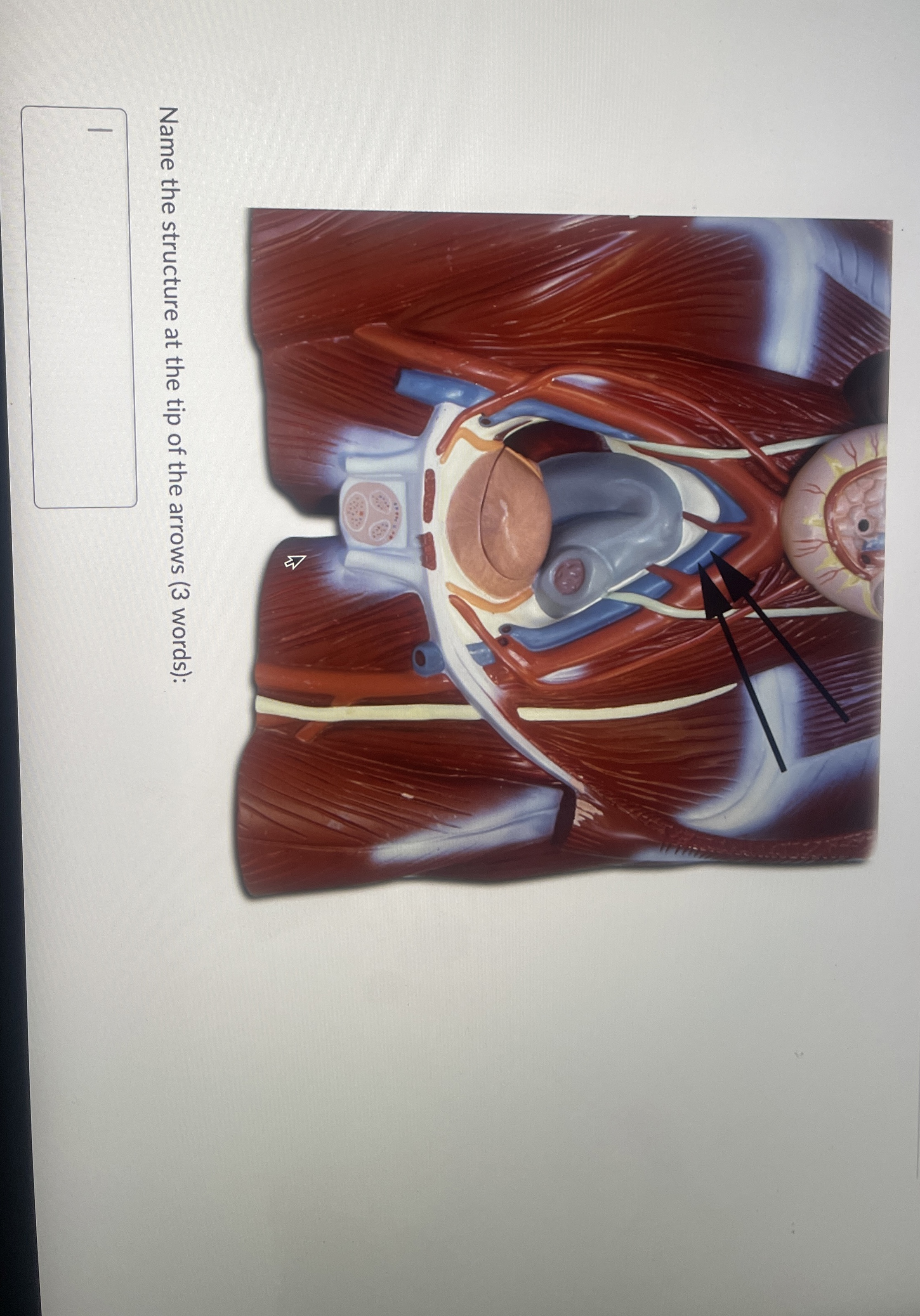 Solved Name the structure at the tip of the arrows (3 | Chegg.com