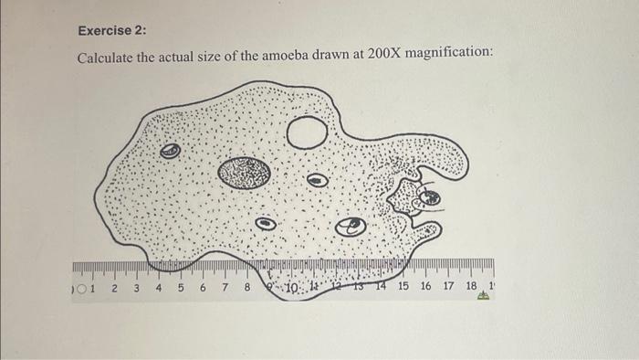 Solved Exercise 2: Calculate the actual size of the amoeba | Chegg.com
