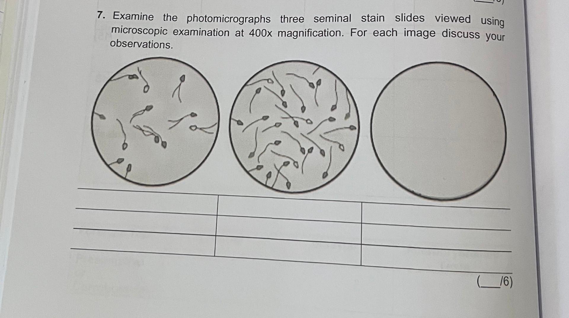 Solved 7. Examine the photomicrographs three seminal stain | Chegg.com