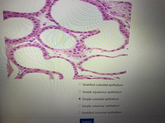 Solved Stratified cuboidal epithelium O Simple squamous | Chegg.com